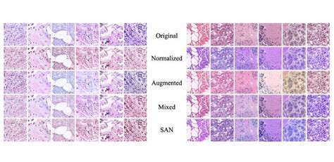 Color Adjusting Technique For Histopathology Image Datasets Could Help