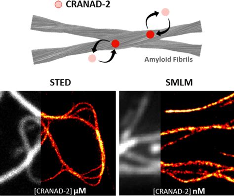 Versatile Near‐infrared Super‐resolution Imaging Of Amyloid Fibrils With The Fluorogenic Probe