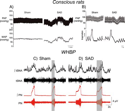 A Recordings Of Pulsatile Pap And Mean Arterial Pressure Map Of One