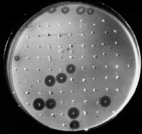 Selection Of Mices Faeces Isolates For Antibacterial Activity By Agar