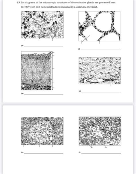 Solved Exercise 27 Functional Anatory Of The Endocrine