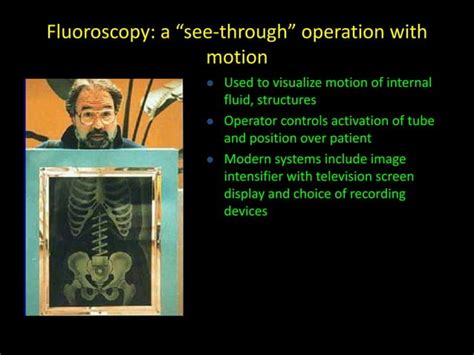 Fluroscopy Pptx Eye And Vision Conditions Diseases And Conditions