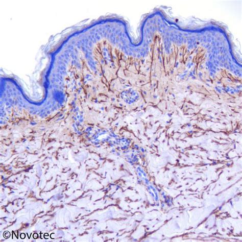 Aging In The Dermis Fibroblast Senescence And Its Significance Via Wiley Cosmetics Testing News