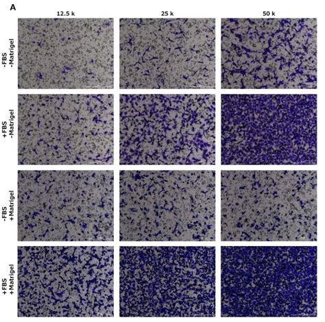 Cell Migration And Invasion Assay Guidance Using Millicell® Cell Culture Inserts