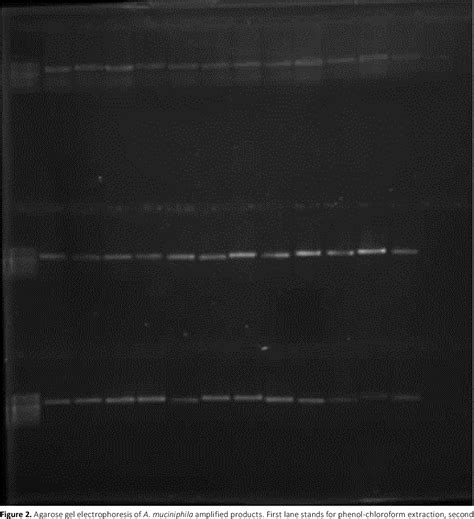 Figure 2 From Comparison Of Bacterial Dna Extraction Methods From Stool Samples For Quantitative