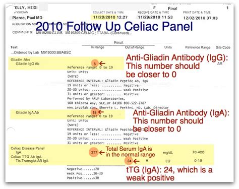 Celiac Disease Is An Autoimmune Disorder Resulting From Dietary Gluten