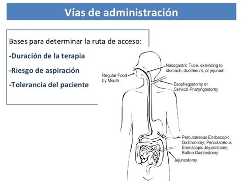 Nutrición Enteral