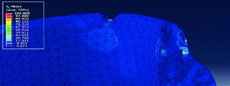 Pattern Of Stress Distribution In Bone Around Short 6 Mm Implants Download Scientific Diagram