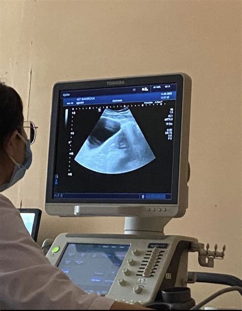 Pinterest Ultrasound Technician Ultrasound Pictures Medical Careers