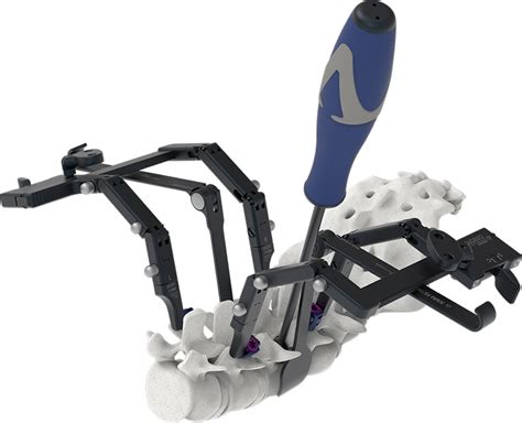 Reconstruction Ulnar Shortening Osteotomy For Distal