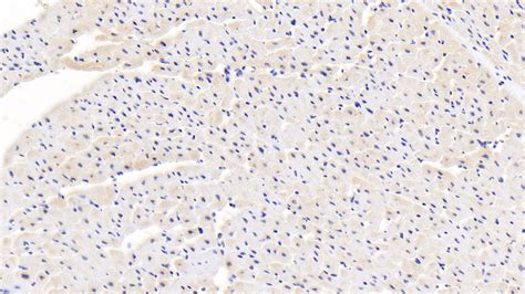 Pab486hu02 钙网蛋白 Calr 多克隆抗体 Homo Sapiens Human，人 Uscn 武汉优尔生商贸有限公司