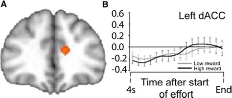 Figure 8 From Frontal Cortex And Reward Guided Learning And Decision