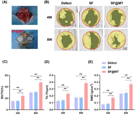 Figure 6 From Melatonin Encapsuled Silk Fibroin Electrospun Nanofibers