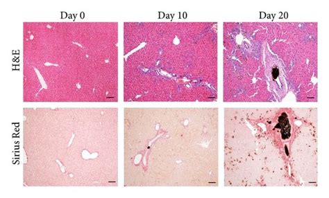 Dynamic Expression Of Ccn Proteins In Hpc And Human Cca Tumors A Download Scientific Diagram