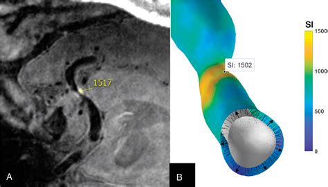 Figure 1 From 3d Enhancement Color Maps In The Characterization Of