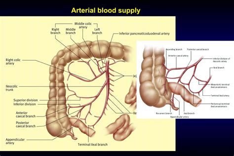 01 Acute Appendicitis And Chronic Appendicitis Pdf