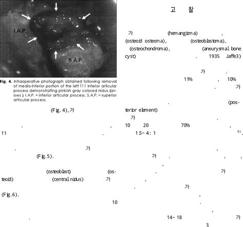 Figure 1 From Osteoid Osteoma Of The Thoracic Spine Semantic Scholar