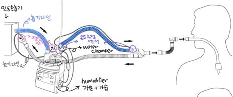 인공호흡기 기초편 1탄🫨 인공호흡기의 원리 널스빌리지