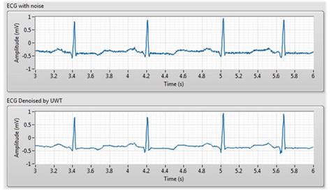 Nibp Analyzer Conclusion The Various Modules Of The Health Care System Download Scientific