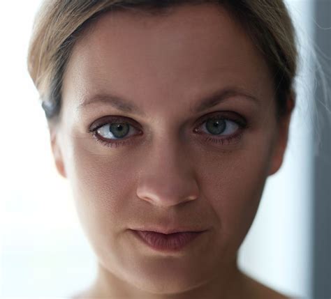 100 Result Oriented Squint Treatment In Varanasi