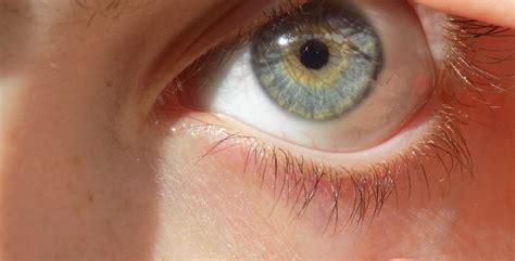 Grey And Brown Heterochromia Understanding Eye Color Variation