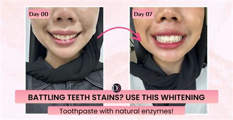 Darlie All Shiny White Enzyme Toothpaste Review