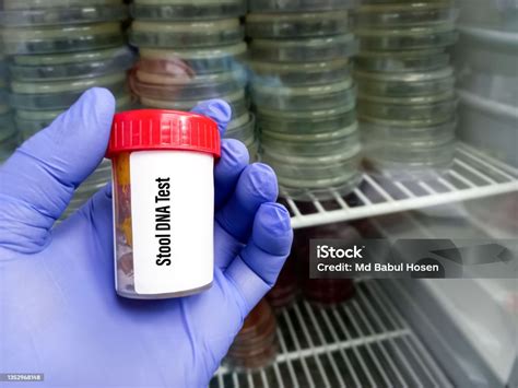 대변 Dna 검사 또는 대변 Dna 검사를 위한 대변 견본을 가진 플라스틱 견본 용기 결장암을 위한 검열하는 새로운 방법 0명에 대한 스톡 사진 및 기타 이미지 Istock