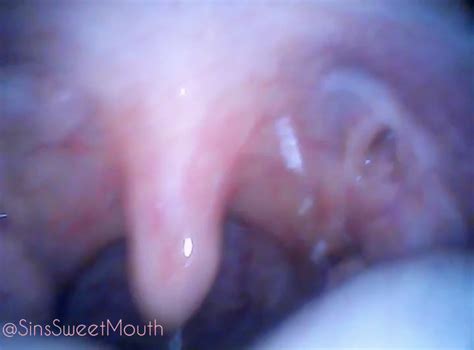 Ebony Giantess Endoscope Vore ThisVid Com