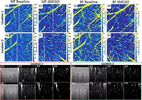 The Ed Based Algorithm Is Capable Of Visualizing And Quantifying The Download Scientific