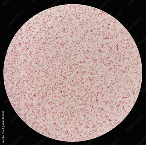 Gram Negative Bacilli