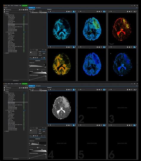 mri image analysis and workflow software platform launched healthcare