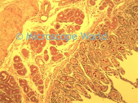 Microscope World Blog Duodenum Under The Microscope