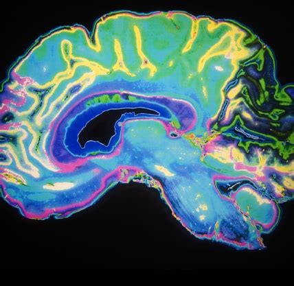 Diffusion Tensor Imaging BrainLine