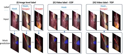 Weakly Supervised Yolo Network For Surgical Instrument Localization In Endoscopic Videos Ai