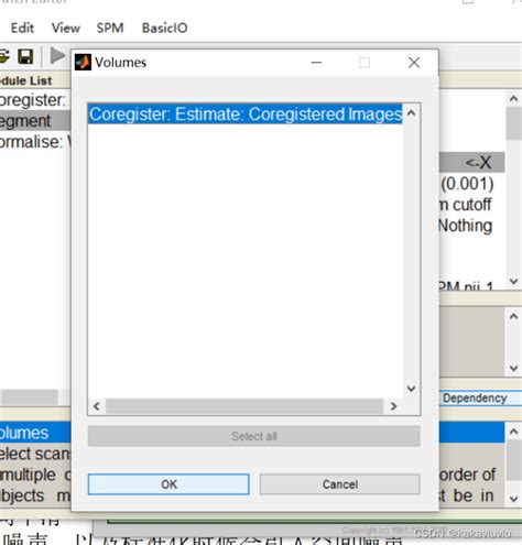 使用spm预处理fmri数据fmri中的tr是什么意思 Csdn博客
