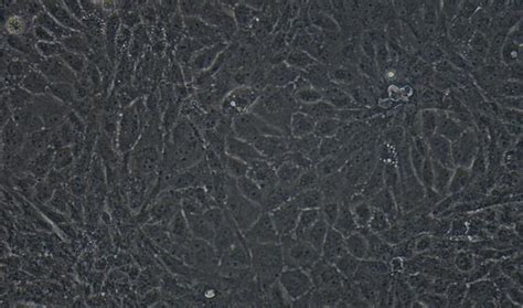 Csi122mu01 Primary Mouse Testicular Endothelial Cells Tec Mus