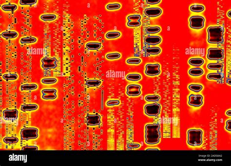 Dna Sequences Computer Artwork Of An Autoradiogram Of Dna Deoxyribonucleic Acid Sequences A Dna Sequences Computer Artwork Of An Autoradiogram Of Dna Deoxyribonucleic Acid Sequences A