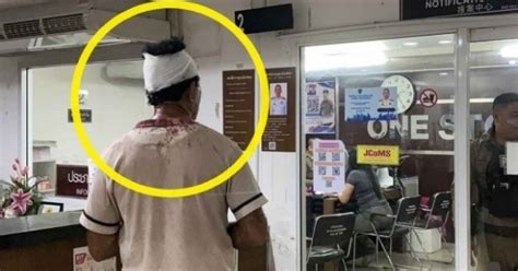 여자 맞아” 트랜스젠더 중요 부위 만졌다가 하이힐로 머리 깨진 관광객