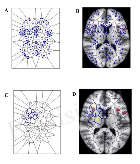Shows The Segmentation Of Fmri Images Into Small Polygons Which Makes Download Scientific