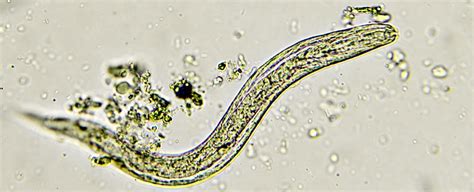 Pinworm Under Microscope
