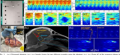 Figure 1 From Super Resolution With Embedded Denoising Via Image Frequency Separation And