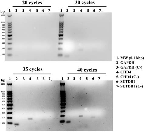 Figure 1 From Evidence Of A Synthetic Lethality Interaction Between Setdb1 Histone
