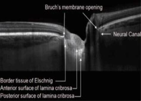 Week 9 2 Oct Scan Interpretation Disc Analysis Flashcards Quizlet