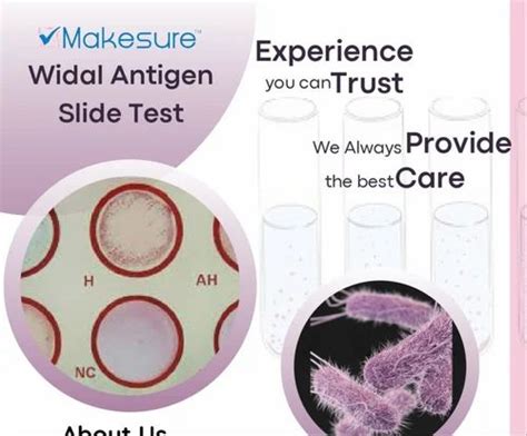 4 5 Ml Makesure Widal Antigen Kit At Rs 450 In Greater Noida Id 2853294664473