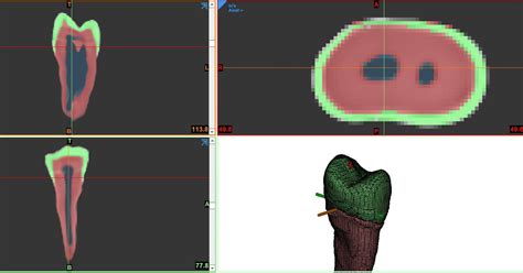 Finite Element Nth Design And Simulation Services