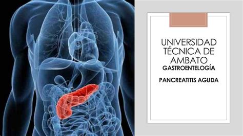 Pancreatitis Aguda Lady Elizabeth Udocz