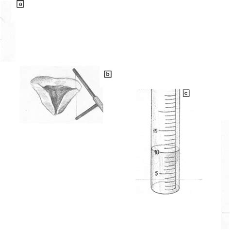 Ultrasound Cervical Length Uscl Assessed In Non Pregnant Women Before Download Scientific