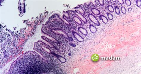 What Is The Purpose Of An Appendix Biomadam