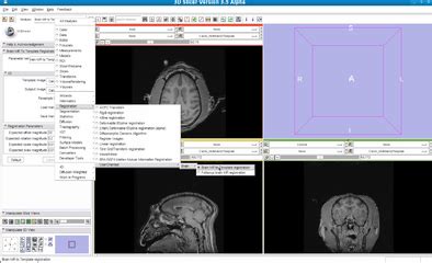 Slicer VisualBlog Slicer Wiki
