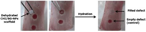 Representation Of A Possible Application Of Chi Nanocomposite For Bone